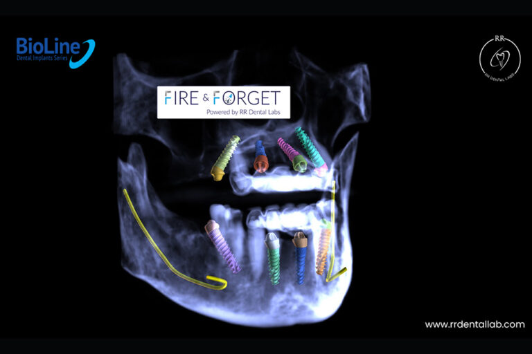Case 103 - RR Dental Lab
