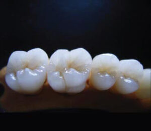 RR Dental Lab | Best Dental Lab in Bangalore, Mumbai, India