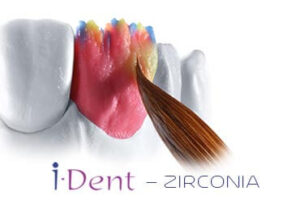 RR Dental Lab | Best Dental Lab in Bangalore, Mumbai, India